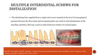 Total arch distalization in orthodontics | PPTX