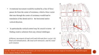 Total arch distalization in orthodontics | PPTX