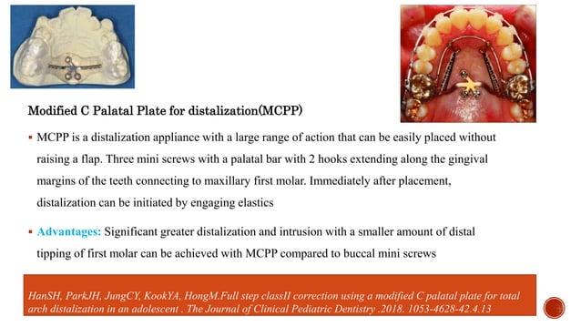 Total arch distalization in orthodontics | PPTX | Dental Health ...