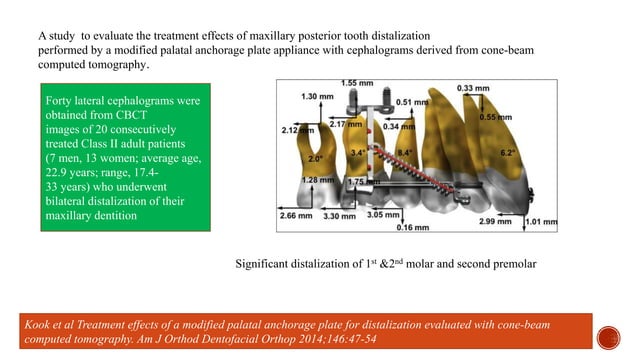Total arch distalization in orthodontics | PPTX | Dental Health ...