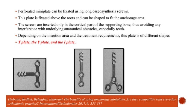 Total arch distalization in orthodontics | PPTX | Dental Health ...