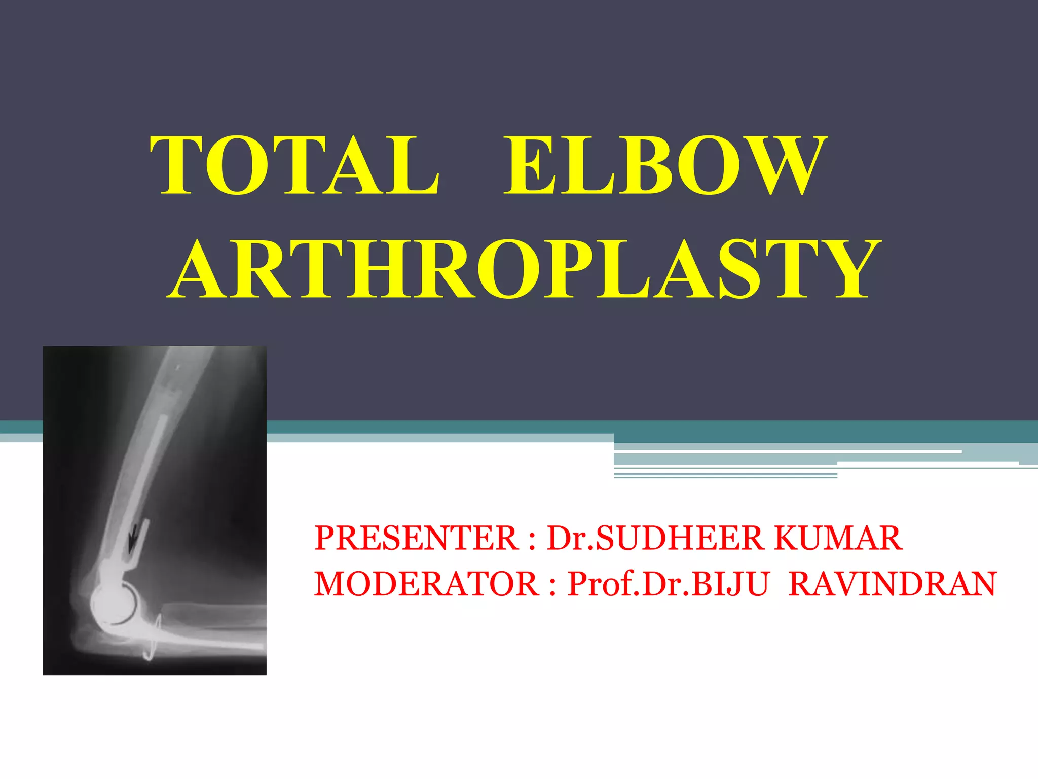 Total elbow arthroplasty | PPTX