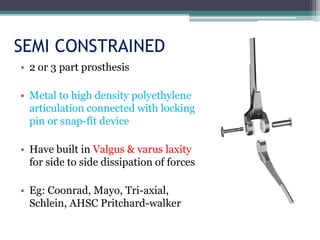 Total elbow arthroplasty | PPTX