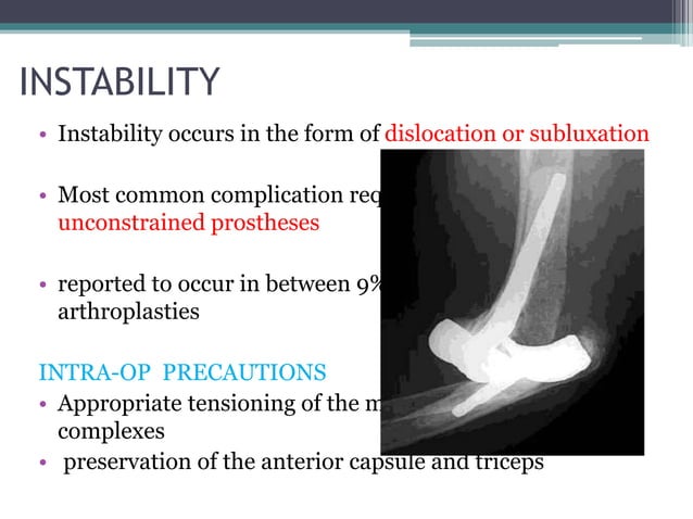 Total elbow arthroplasty | PPT