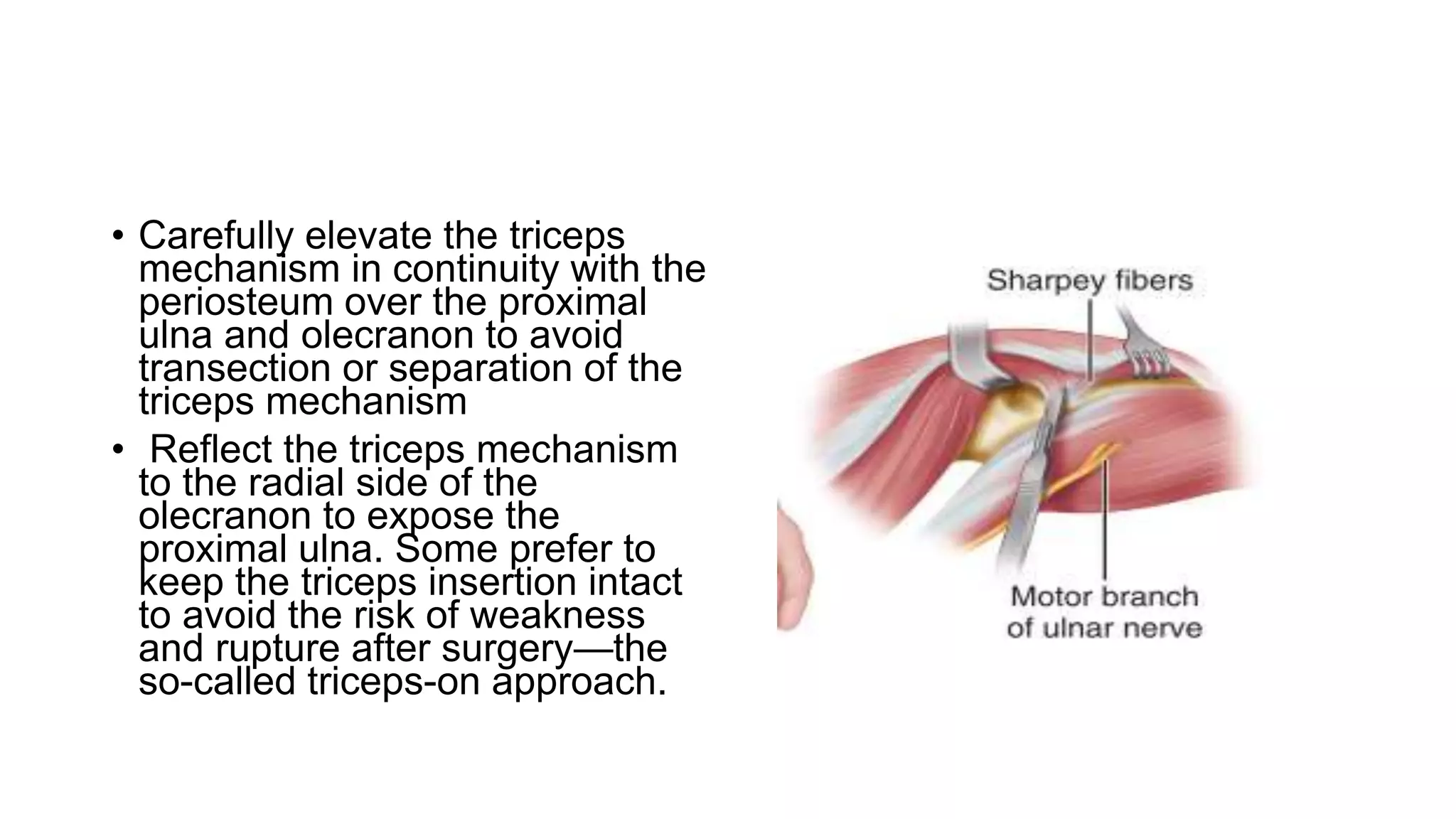 Total elbow arthroplasty | PPTX