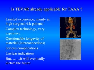 Total endovascular repair for thoraco abdominal aortic aneurysms | PPT