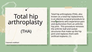 Total hip arthroplasty (THA).pptx goooooood | PPT