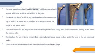 Total Hip Implant | PPTX