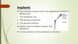 Total hip replacement | PPSX