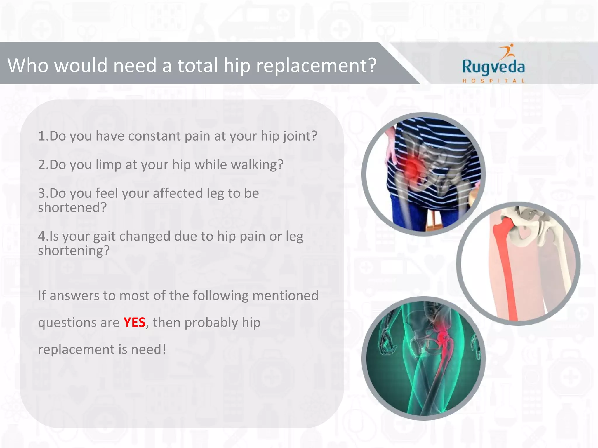 Total hip replacement – a patient guide | PPT