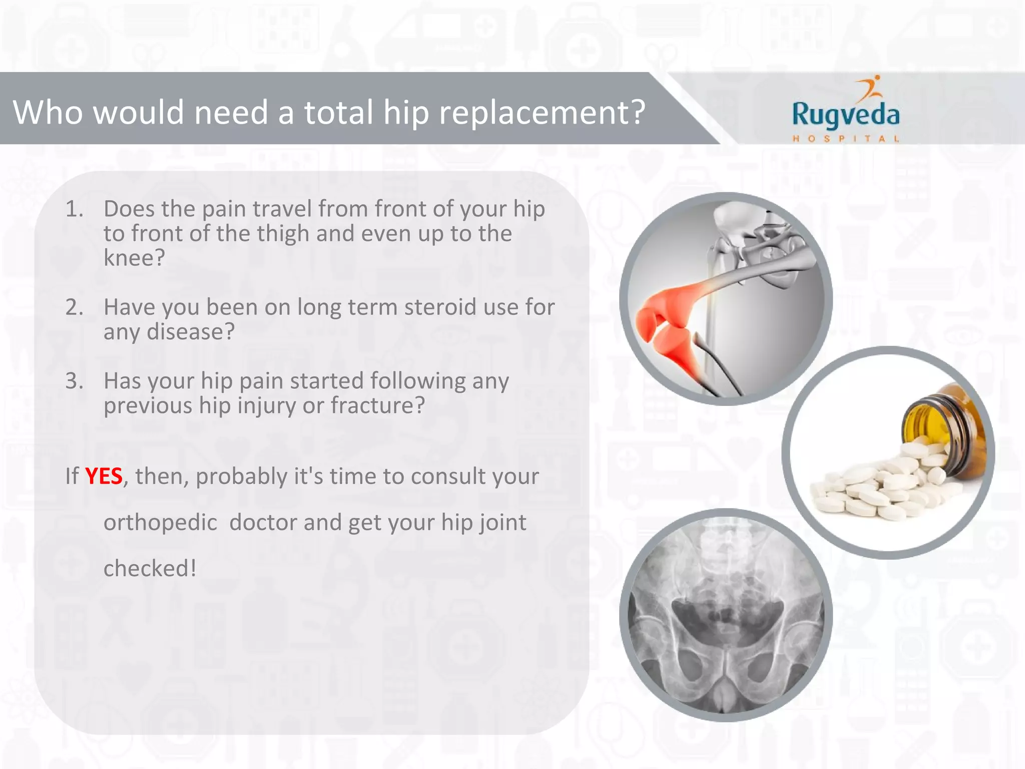 Total hip replacement – a patient guide | PPT