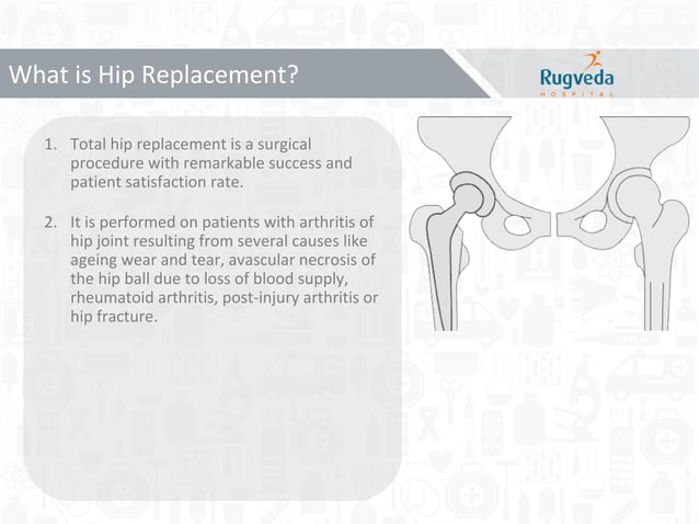 Total hip replacement – a patient guide | PPT | Bone and Joint ...