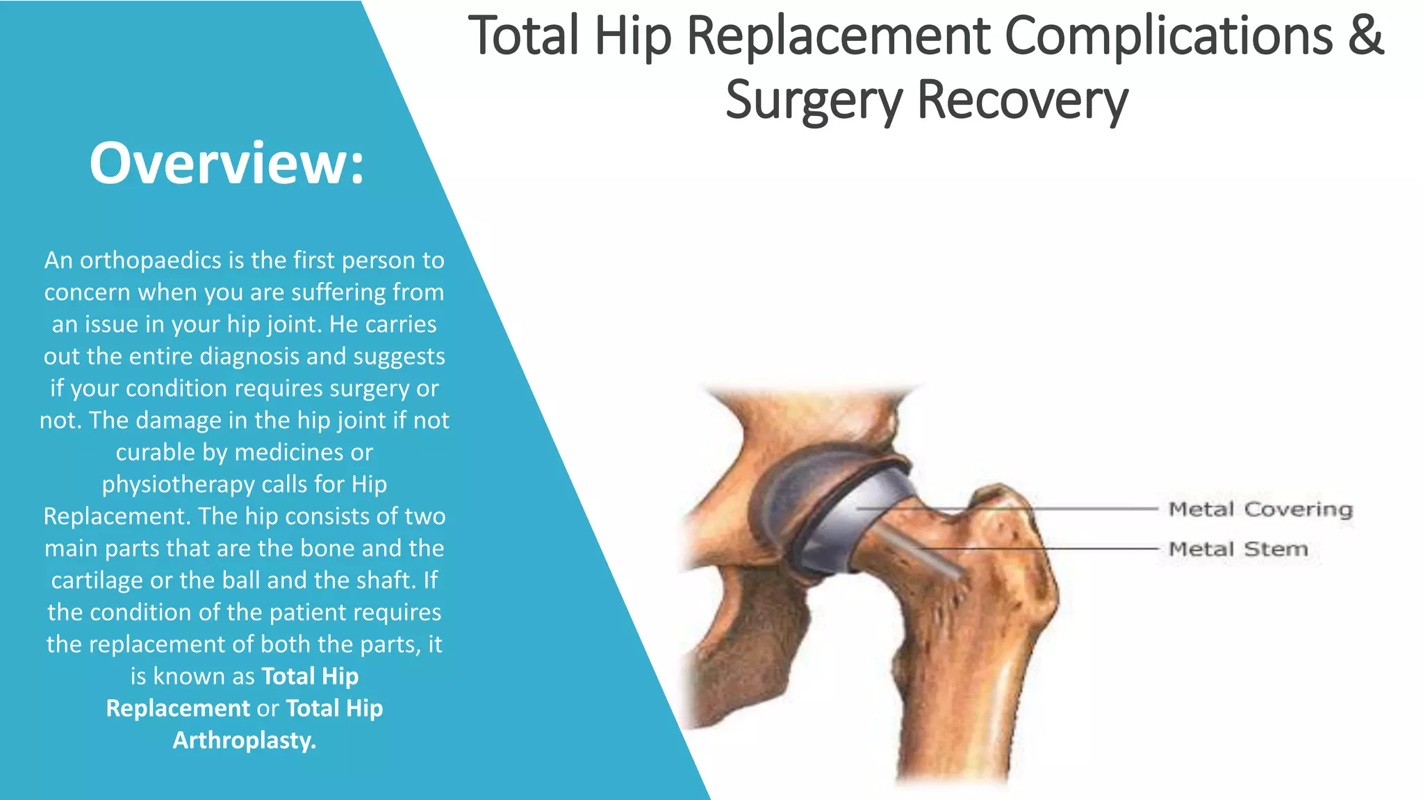 Total Hip Replacement Complications & Surgery Recovery | PPTX