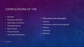 Total hip arthroplasty, dislocation | PDF