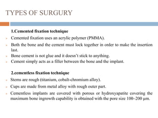Total hip replacement(thr) | PPTX