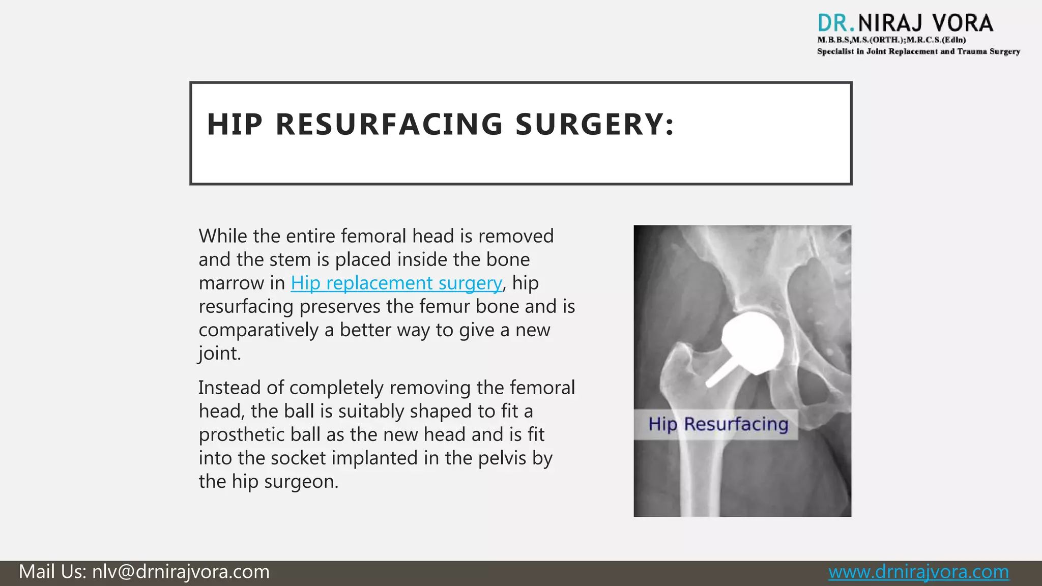Total hip replacement vs hip resurfacing | PPT Total hip replacement vs hip resurfacing | PPT
