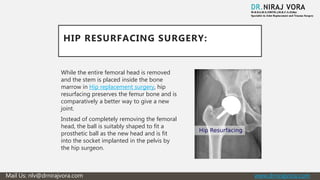 Total hip replacement vs hip resurfacing | PPTX