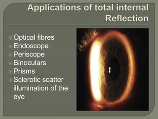 Total internal reflection and critical angle | PPTX