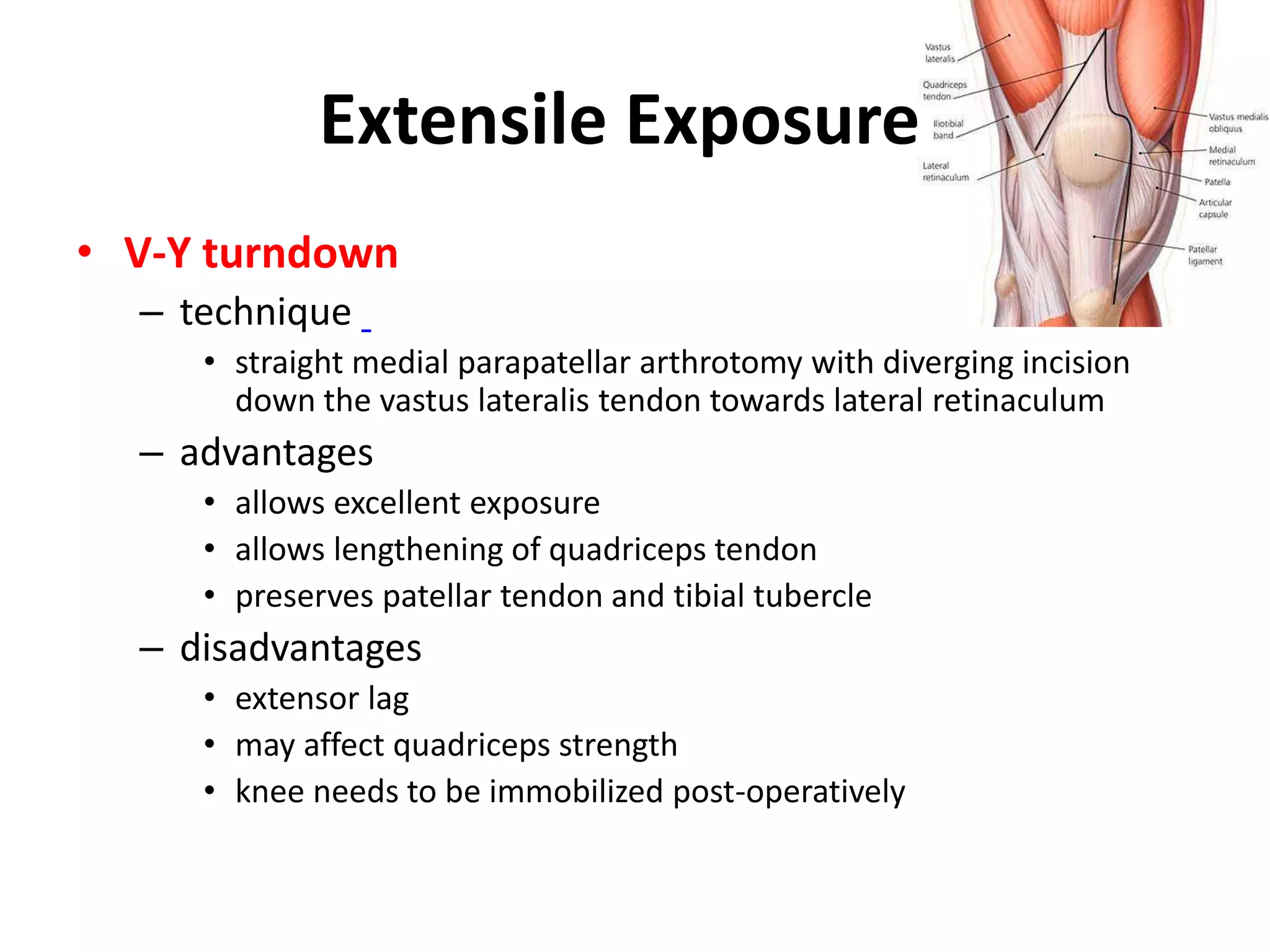 Total knee approaches | PPTX