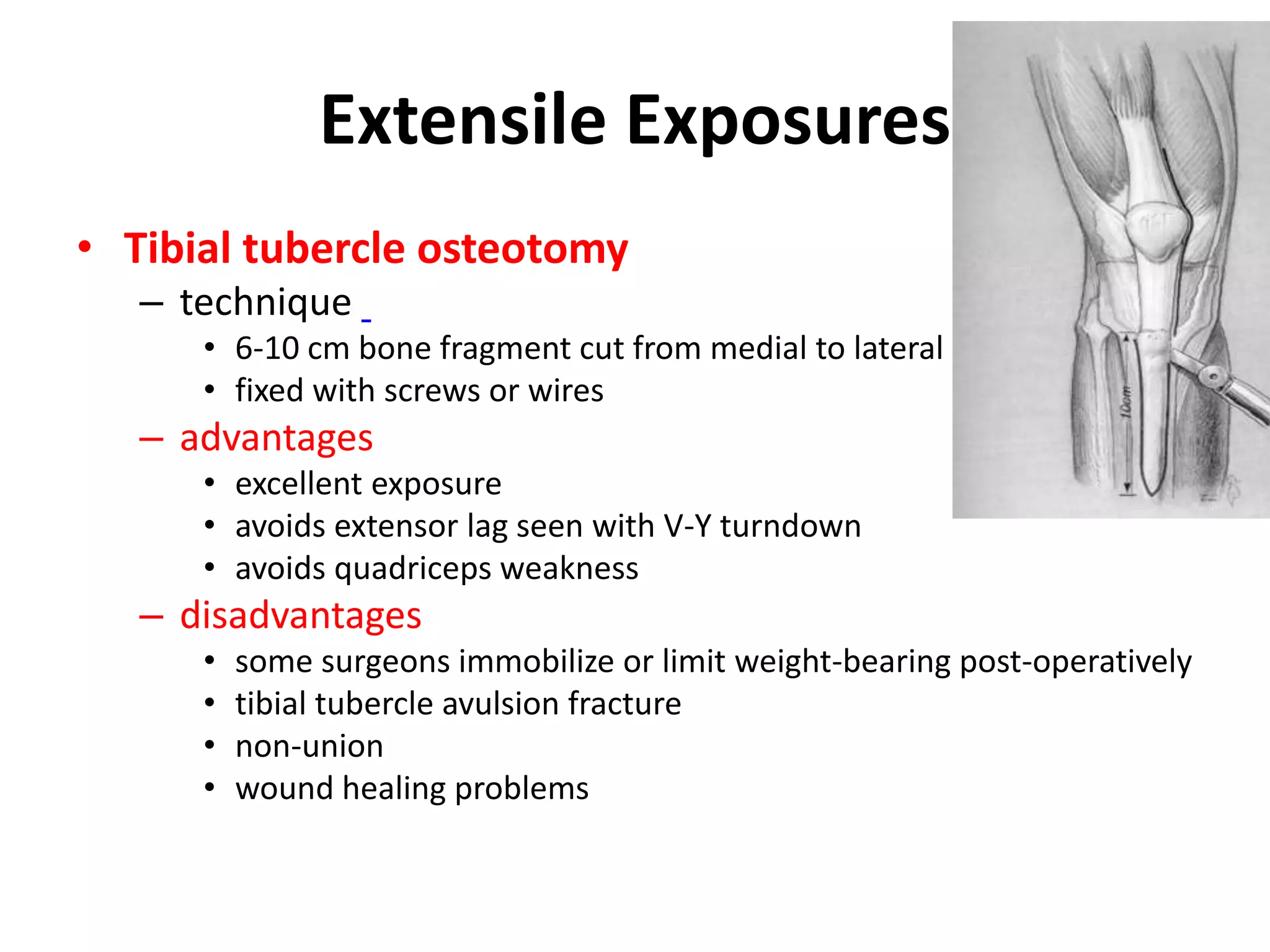 Total knee approaches | PPTX