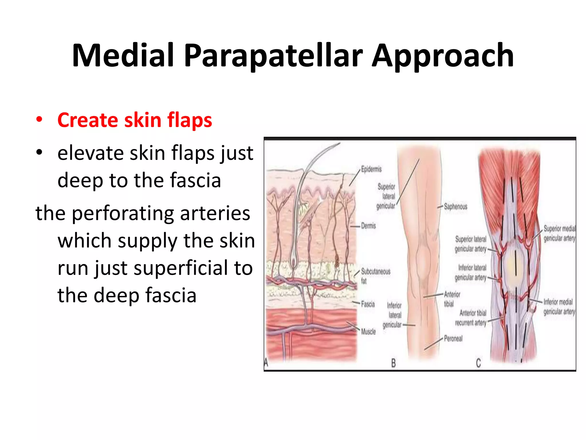 Total knee approaches | PPTX