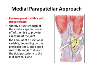 Total knee approaches | PPTX