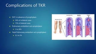 Total Knee Arthroplasty | Knee Replacement | South Windsor, Rocky Hill ...