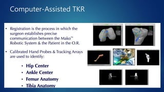 Total Knee Arthroplasty | Knee Replacement | South Windsor, Rocky Hill ...