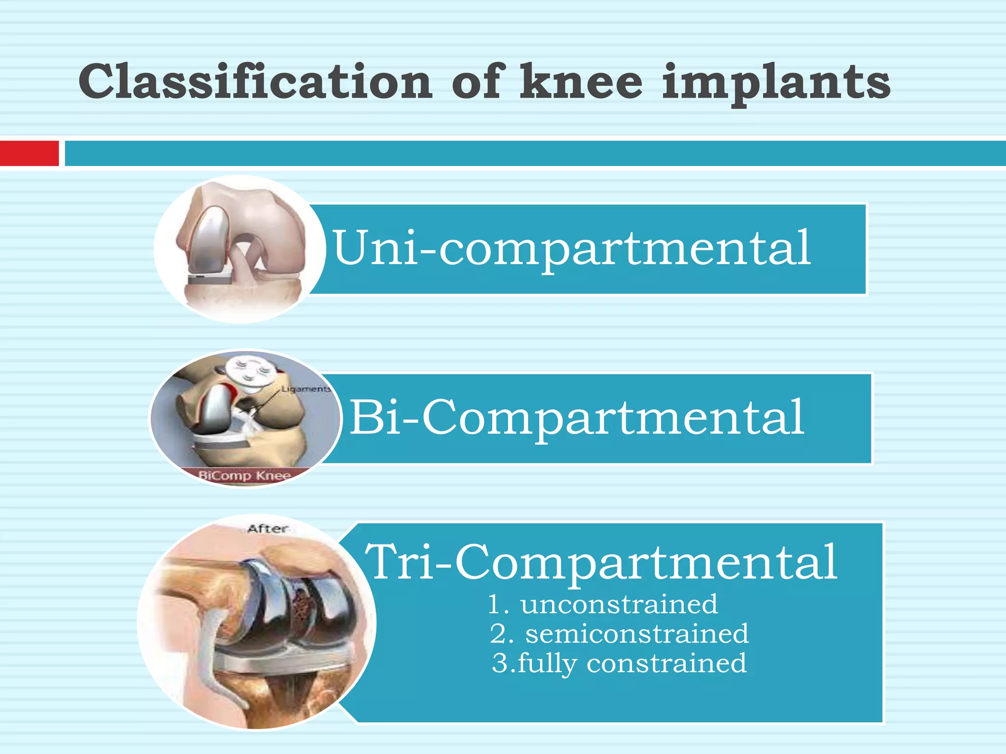 Total knee arthroplasty.pptx
