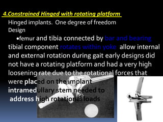 Total knee arthroplasty by dr..ammar m.sheet | PPSX