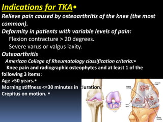 Total knee arthroplasty by dr..ammar m.sheet | PPSX