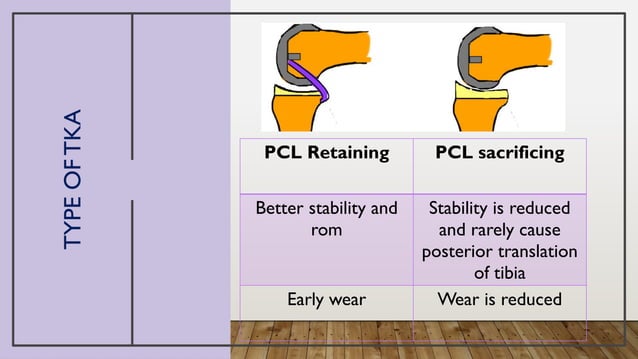 Total knee arthroplasty rehabilitation ( TKR ) | PPTX | Physical Therapy | Wellness