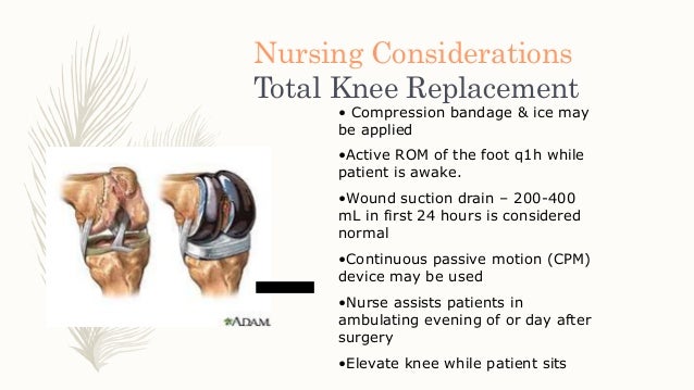 Total knee replacement
