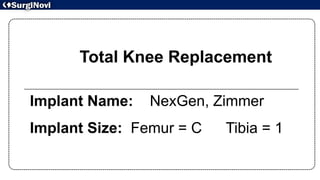Total knee replacement for 120 cm dwarf using custom made surgical ...