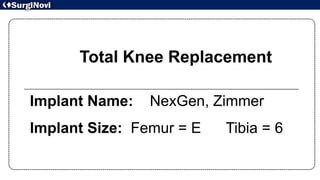 Total knee replacement for patient with retained implant and metal | PPTX