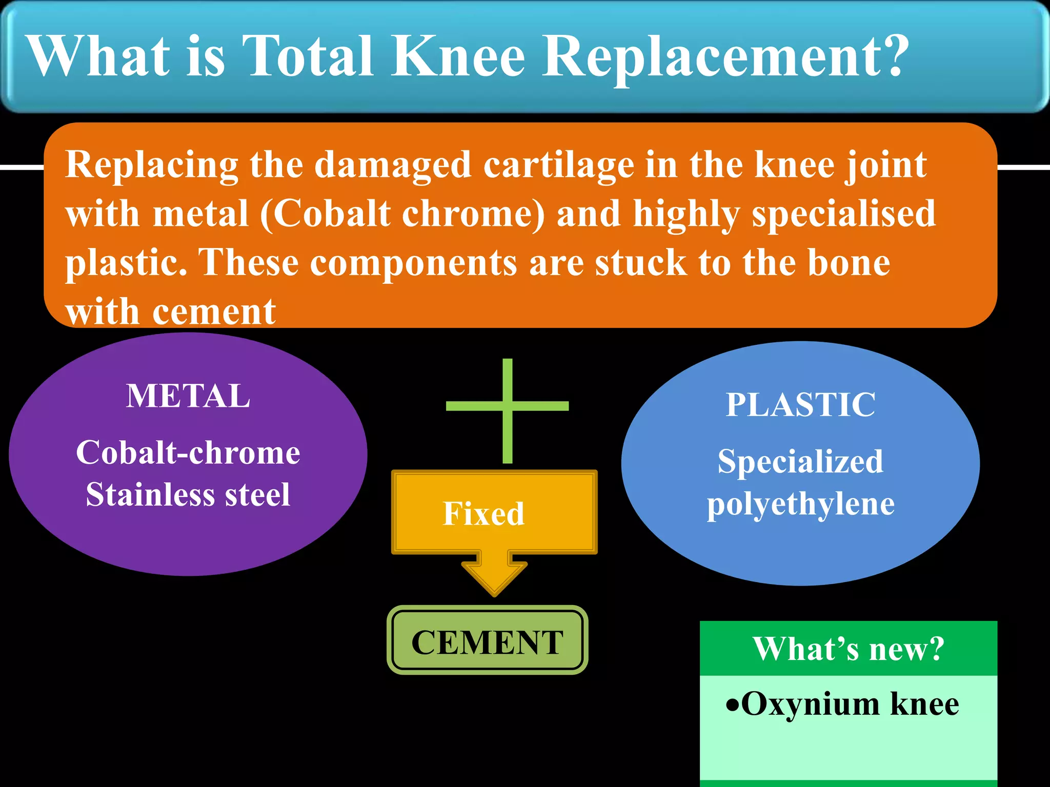 Total knee replacement patient education | PPTX