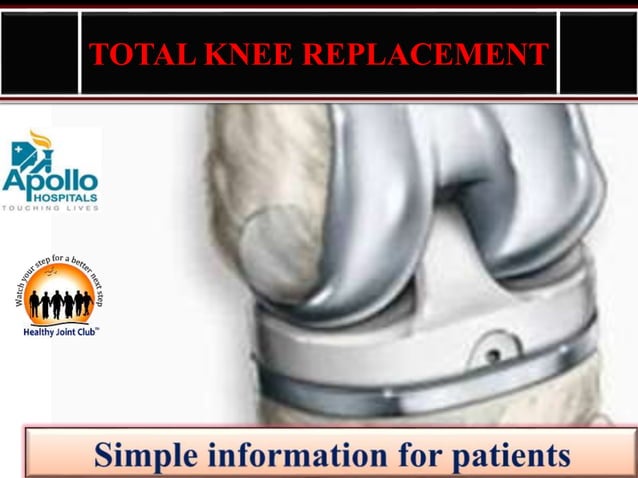 Total knee replacement patient education | PPT