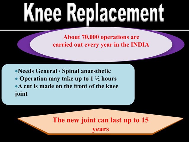 Total knee replacement patient education | PPTX