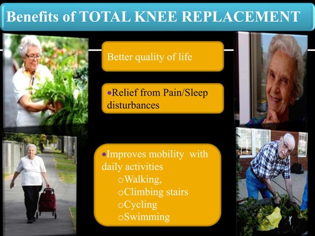 Total knee replacement patient education | PPTX