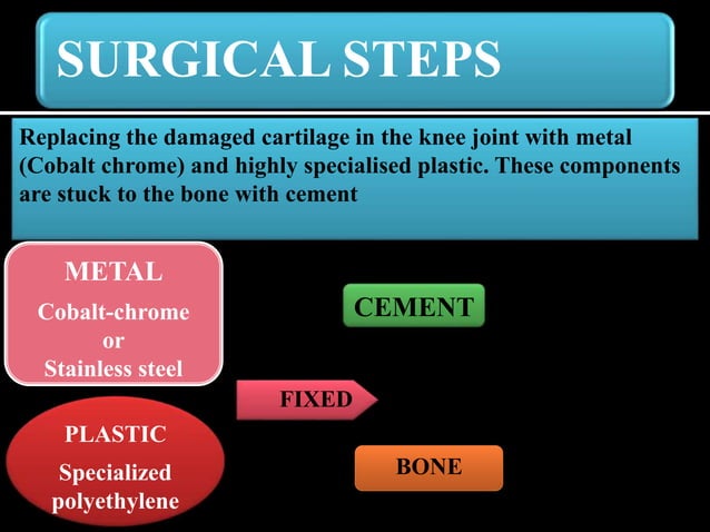 Total knee replacement patient education | PPTX