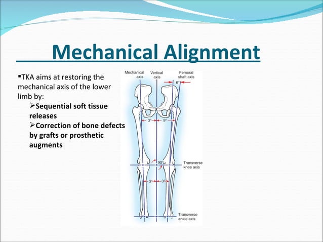 Total knee replacement (tkr) ppt | PPT