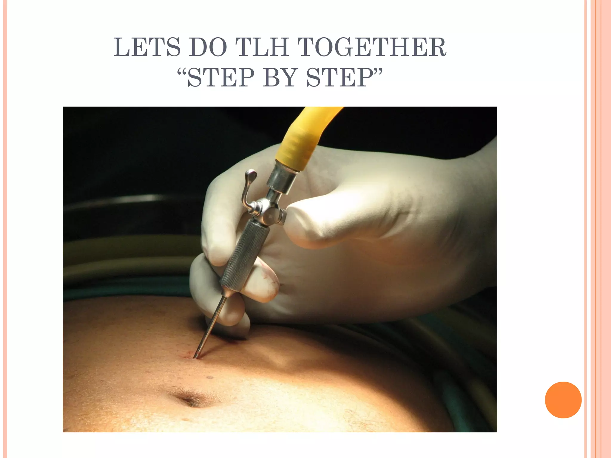 Total Laparoscopic Hysterectomy- Tips, Tricks & Techniques | PPT