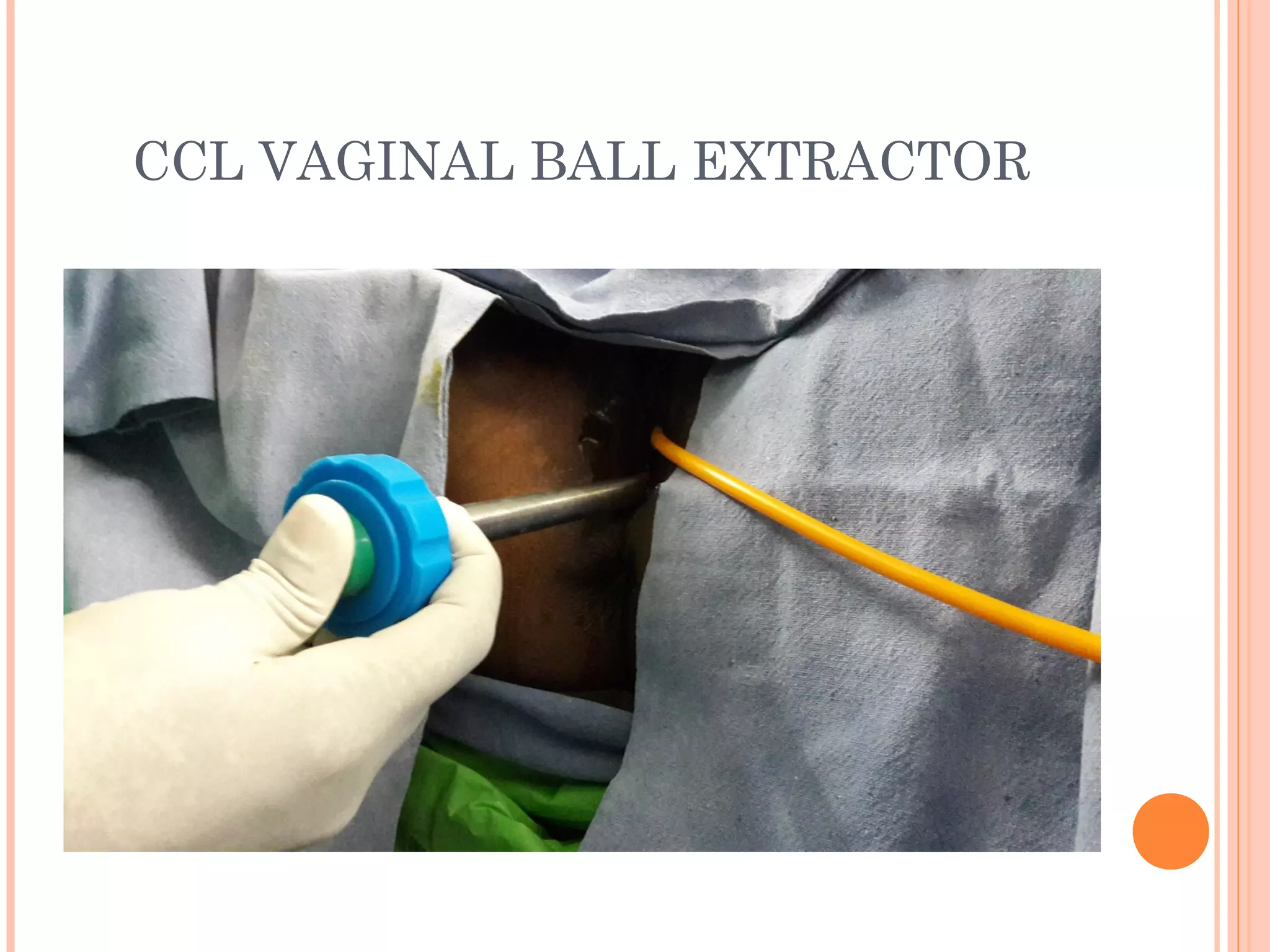 Total Laparoscopic Hysterectomy- Tips, Tricks & Techniques | PPT