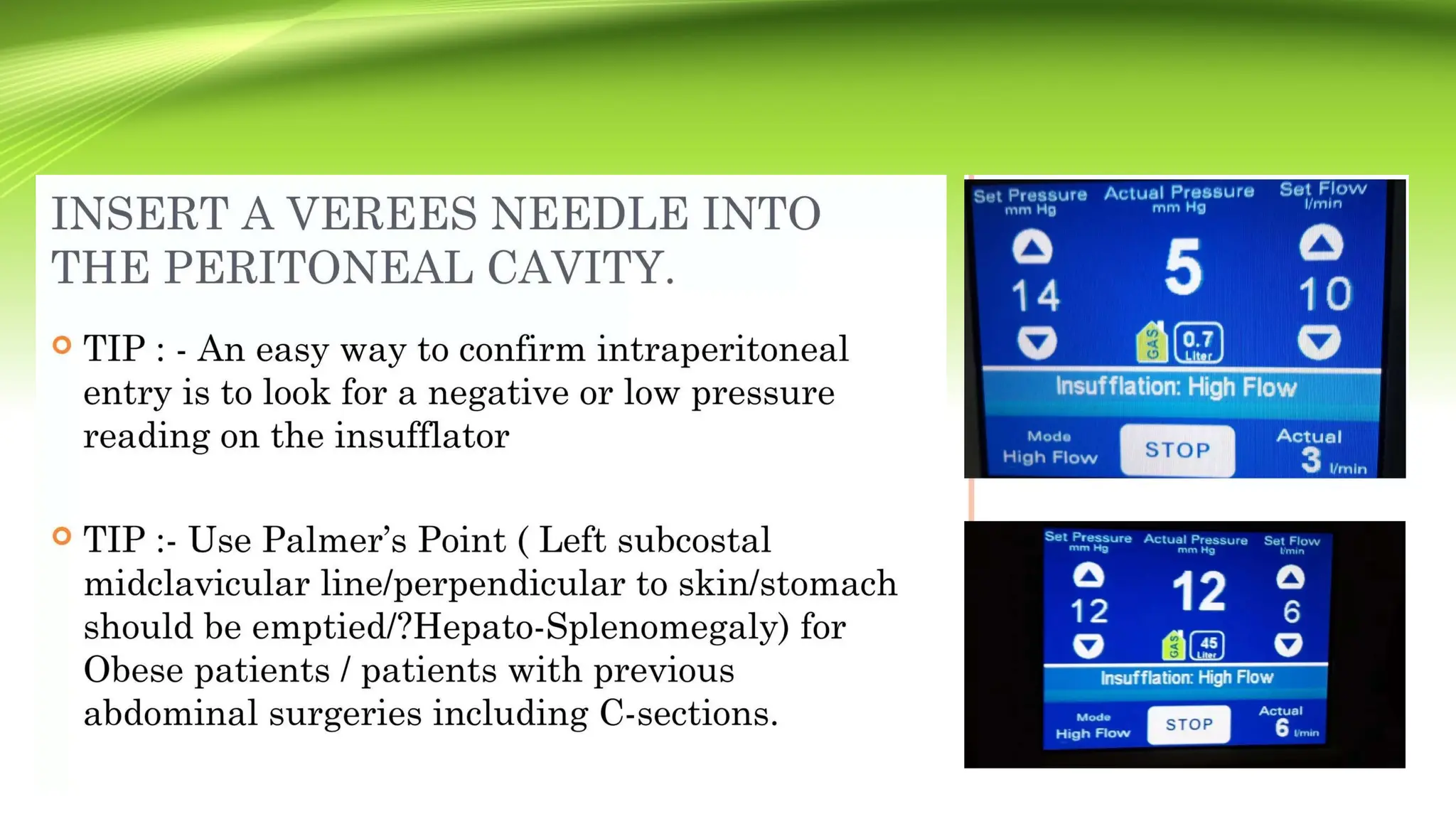 TOTAL LAPROSCOPIC HYSTERECTOMY PROCEDURE | PPT