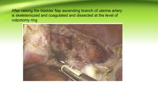 TOTAL LAPROSCOPIC HYSTERECTOMY PROCEDURE | PPT