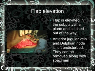 Total laryngectomy | ODP