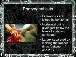 Total laryngectomy | ODP