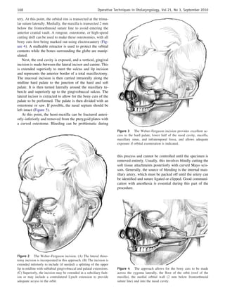 Total maxillectomy | PDF | Ear, Nose and Throat Conditions | Diseases ...