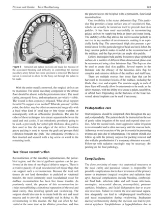 Total maxillectomy | PDF | Ear, Nose and Throat Conditions | Diseases ...
