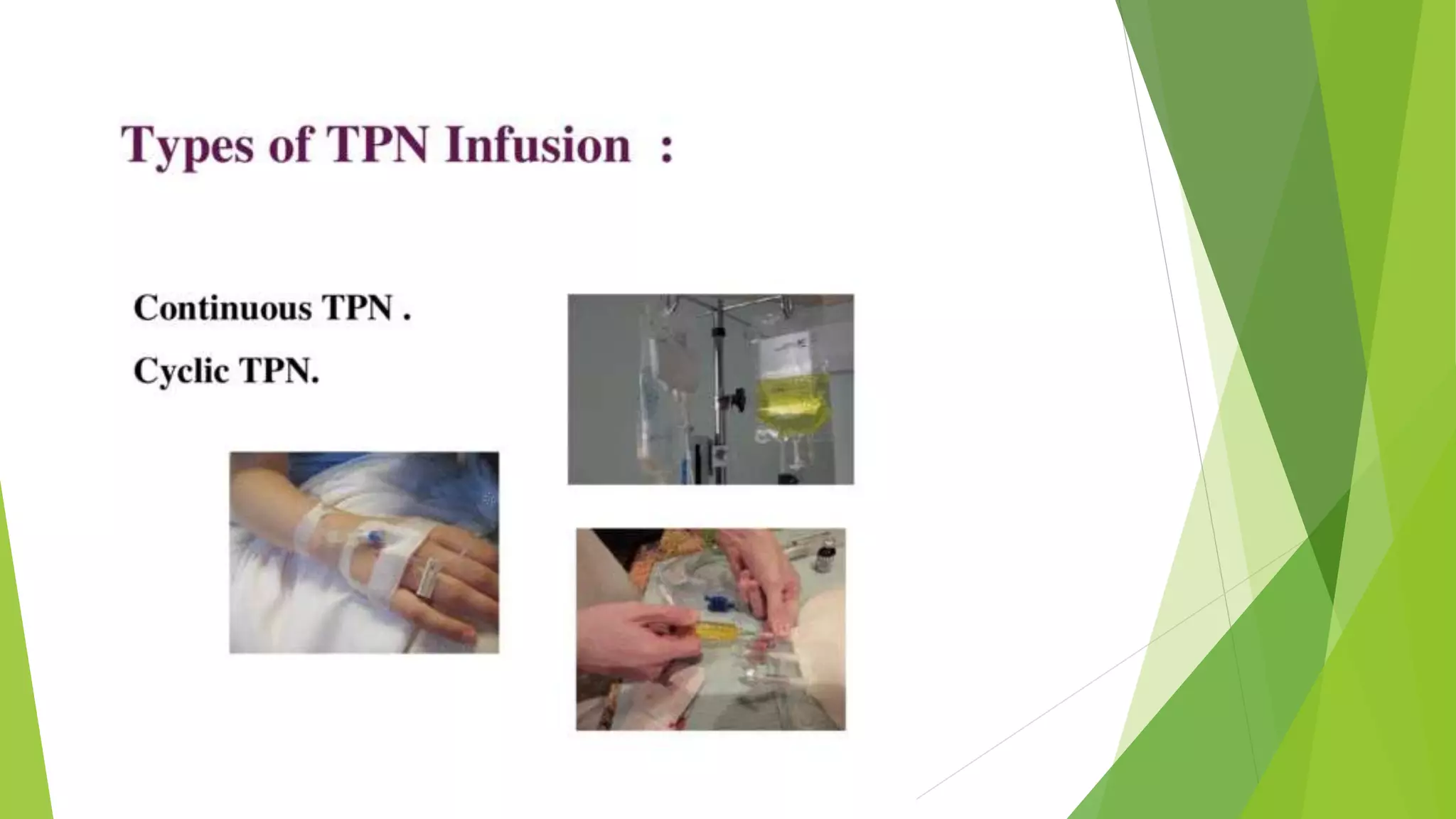 Total parenteral nutrition | PPTX